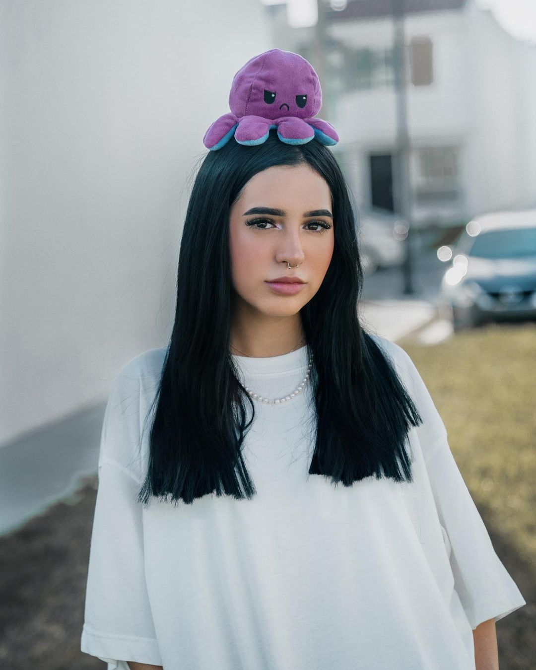 Así quedó Dome Lipa tras quitarse cachete y papada | Es la Moda