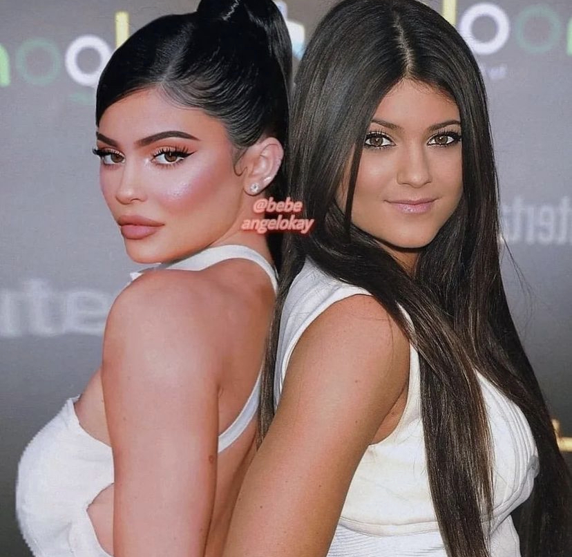 Así de drástica ha sido la evolución del rostro de Kylie Jenner | Es la ...